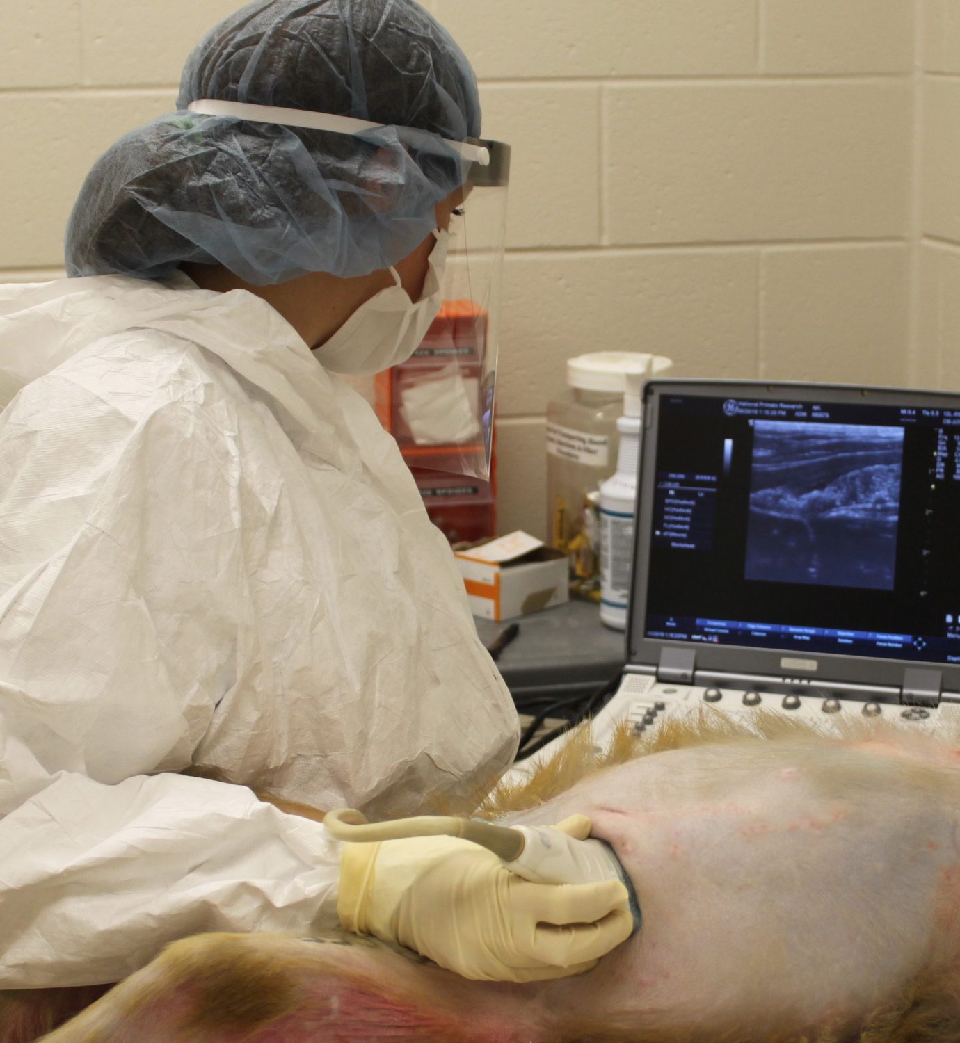 Ultrasound of a pregnant Rhesus monkey that has been infected with Zika ...